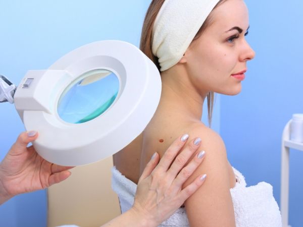 Potreban Vam je dermatolog u Beogradu? - IMedic ordinacija